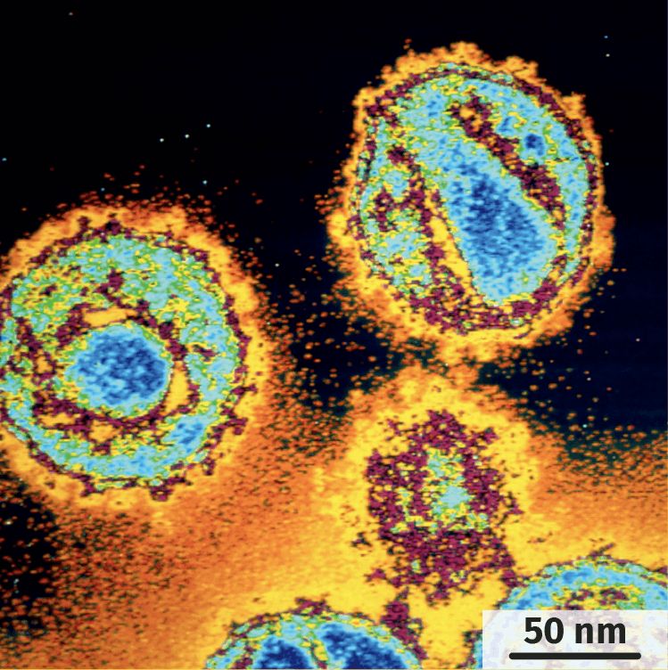 agents pathogènes et maladies | Genially