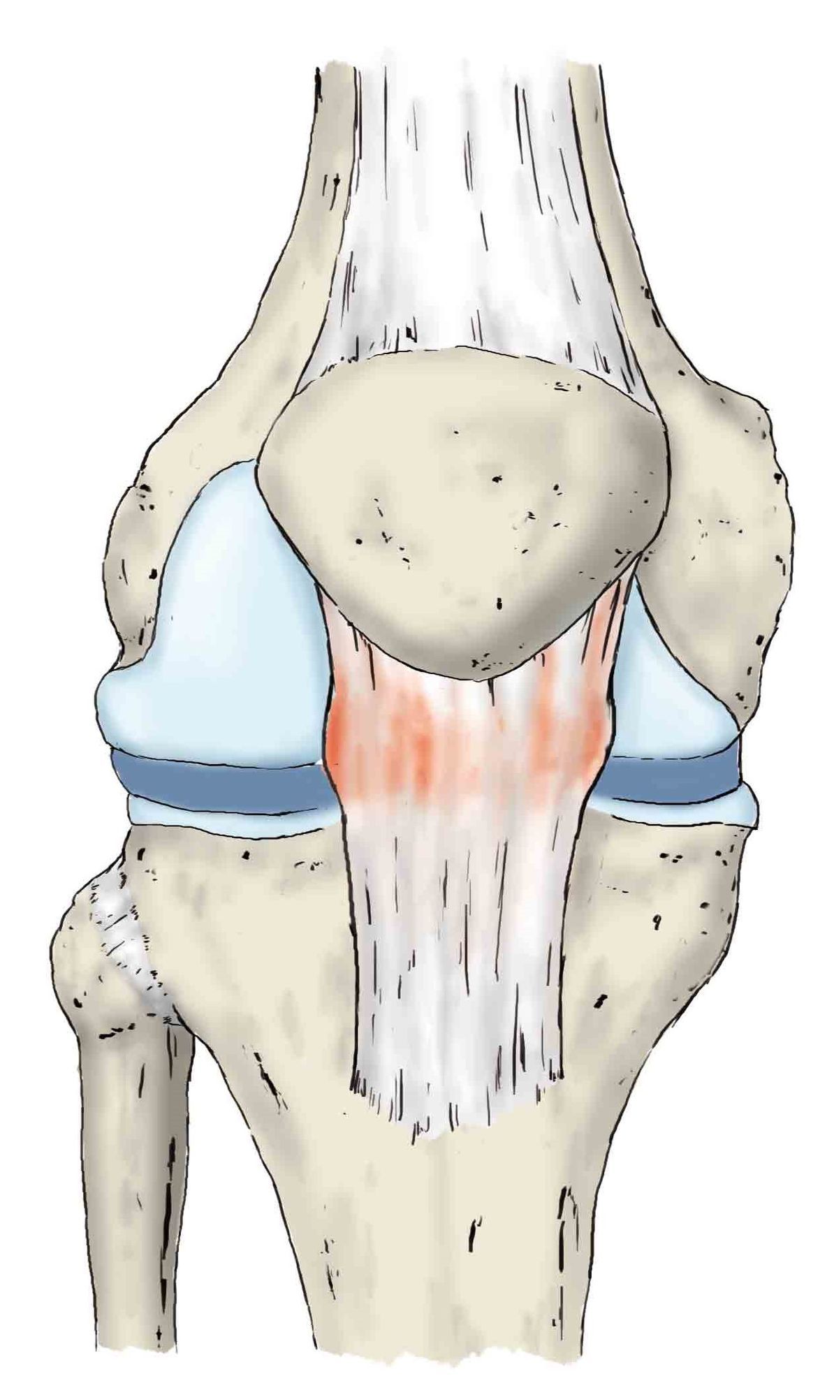 Articulación de rodilla | Genially
