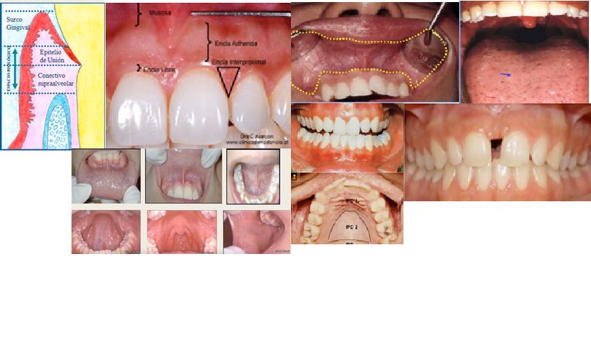 UNIDAD DENTOGINGIVAL | Genially