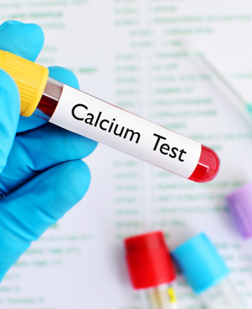 Lab calcium | Genially