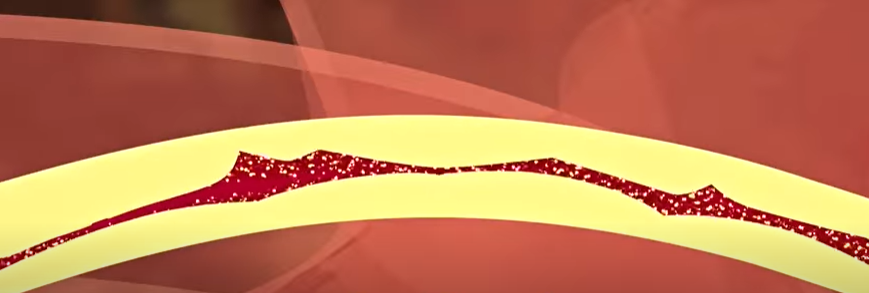 PRAE project | Genially