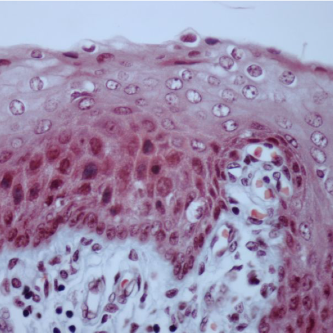 Infografía Tipos de Epitelio | Genially