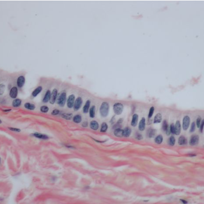 Infografía Tipos de Epitelio | Genially