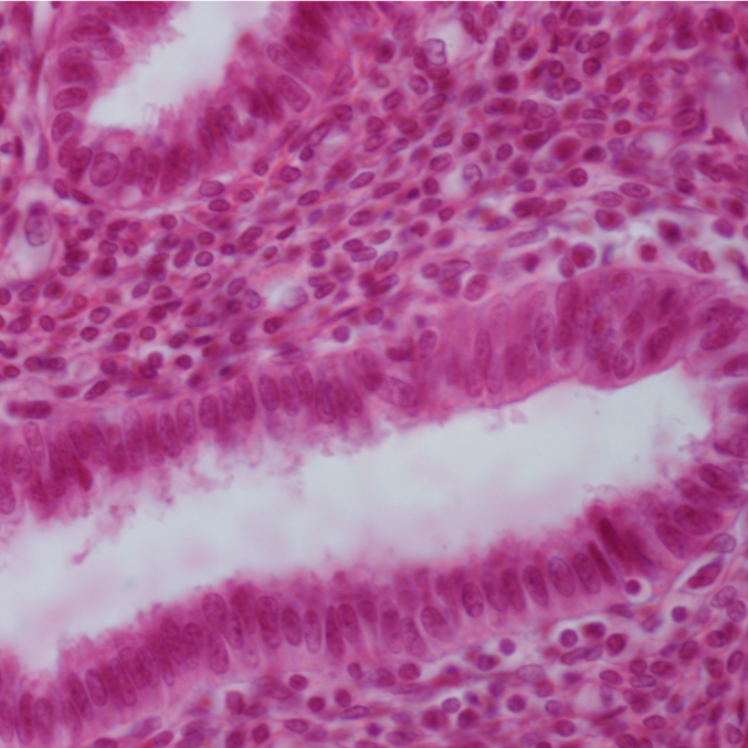 Infografía Tipos de Epitelio | Genially