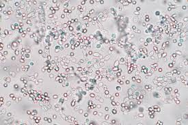 Mohos y Levaduras. Jaime | Genially