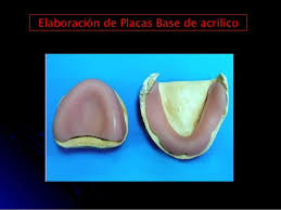 BASE DE REGISTRO Y RODILLOD DE OCLUCION | Genially