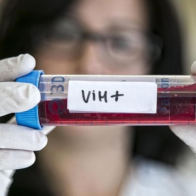 ENFERMEDAD DEL SIDA | Genially