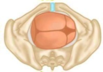 Estática fetal | Genially