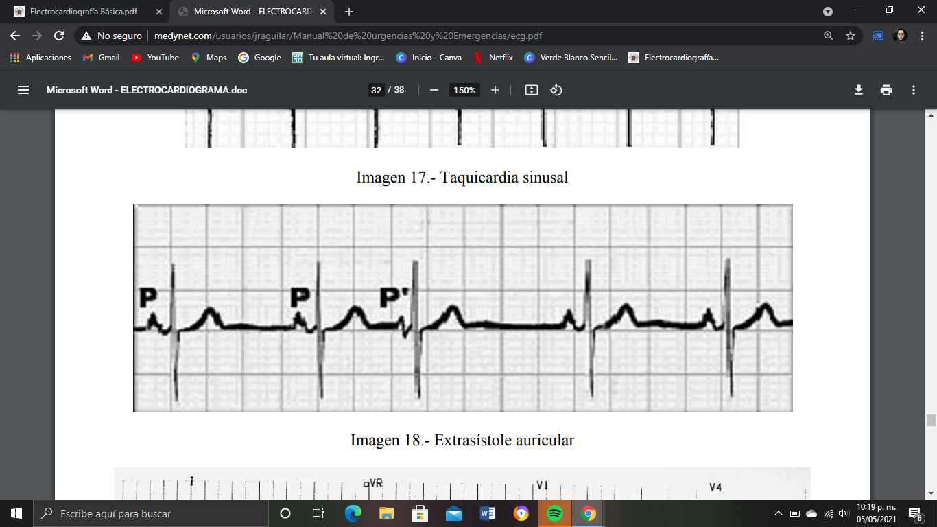 Electrocardiograma | Genially