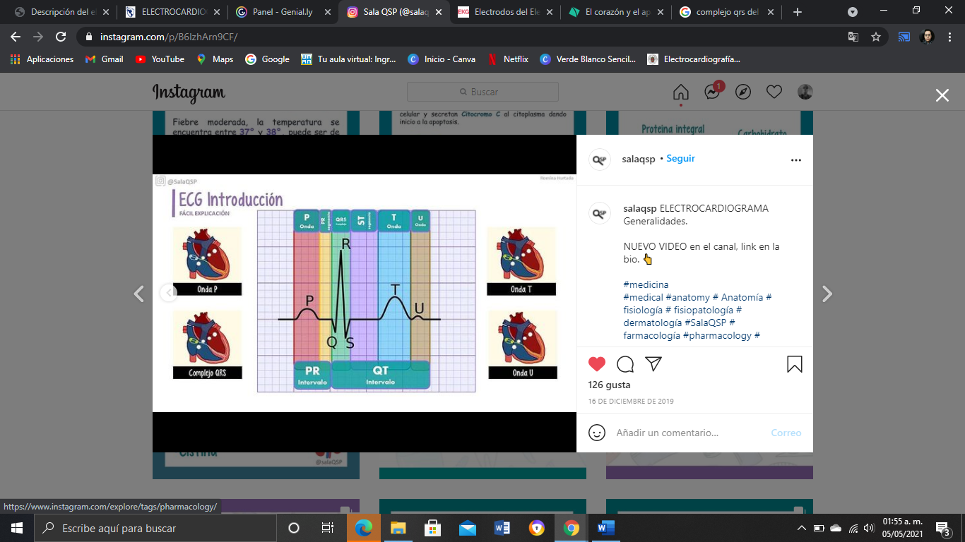 Electrocardiograma | Genially