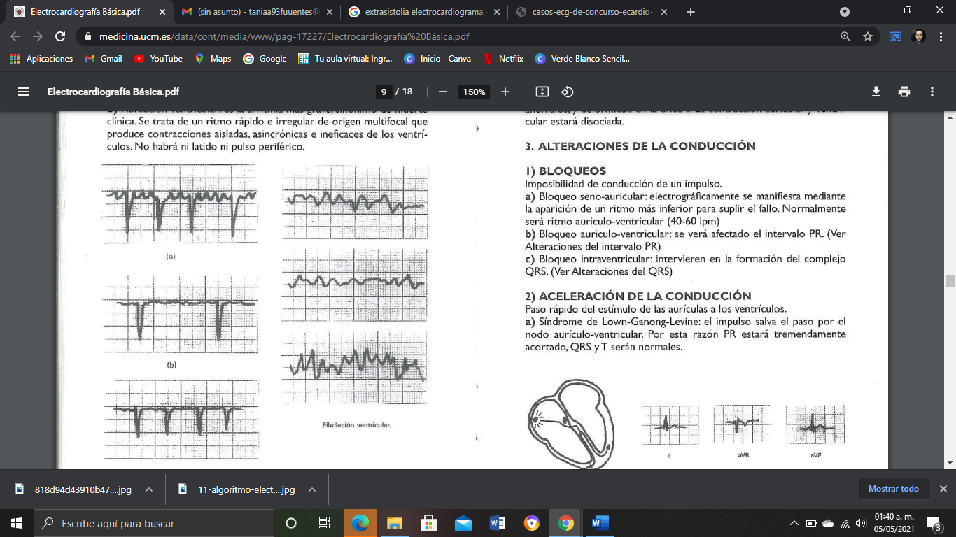 Electrocardiograma | Genially
