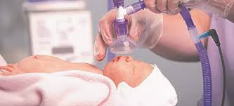 RCP neonatal | Genially